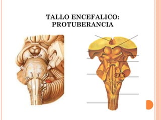 Configuracion interna de tallo cerebral | PDF