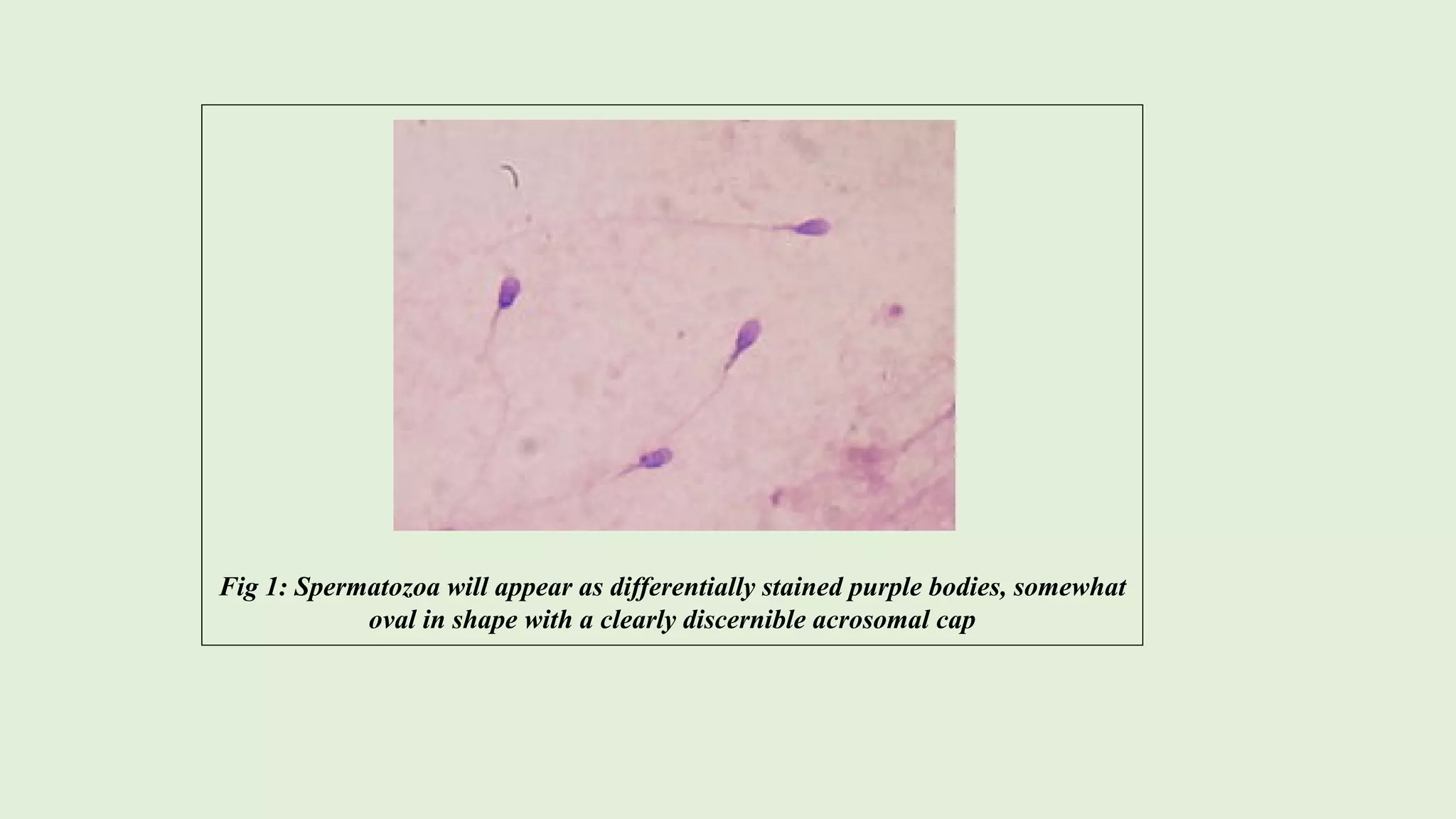 Confirmatory Test for Semen identification | PDF
