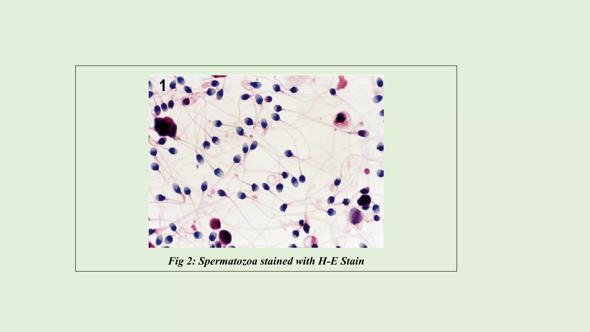 Confirmatory Test for Semen identification | PDF