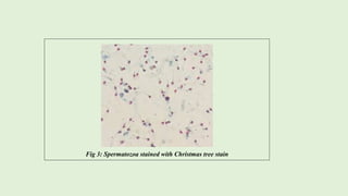 Confirmatory Test for Semen identification | PDF