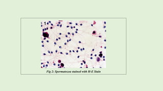 Confirmatory Test for Semen identification | PDF