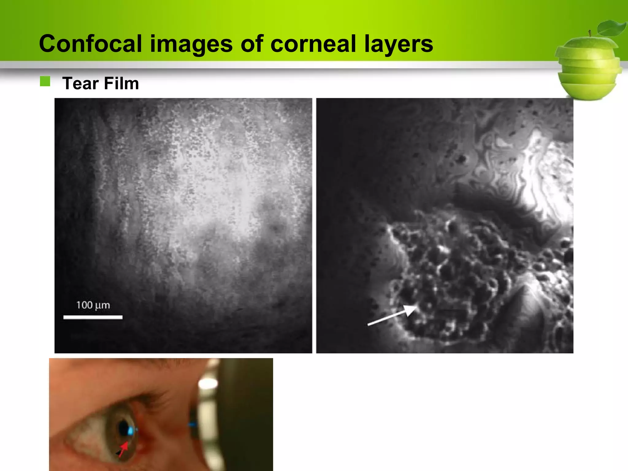 Confocal microscopy of the eye | PPT