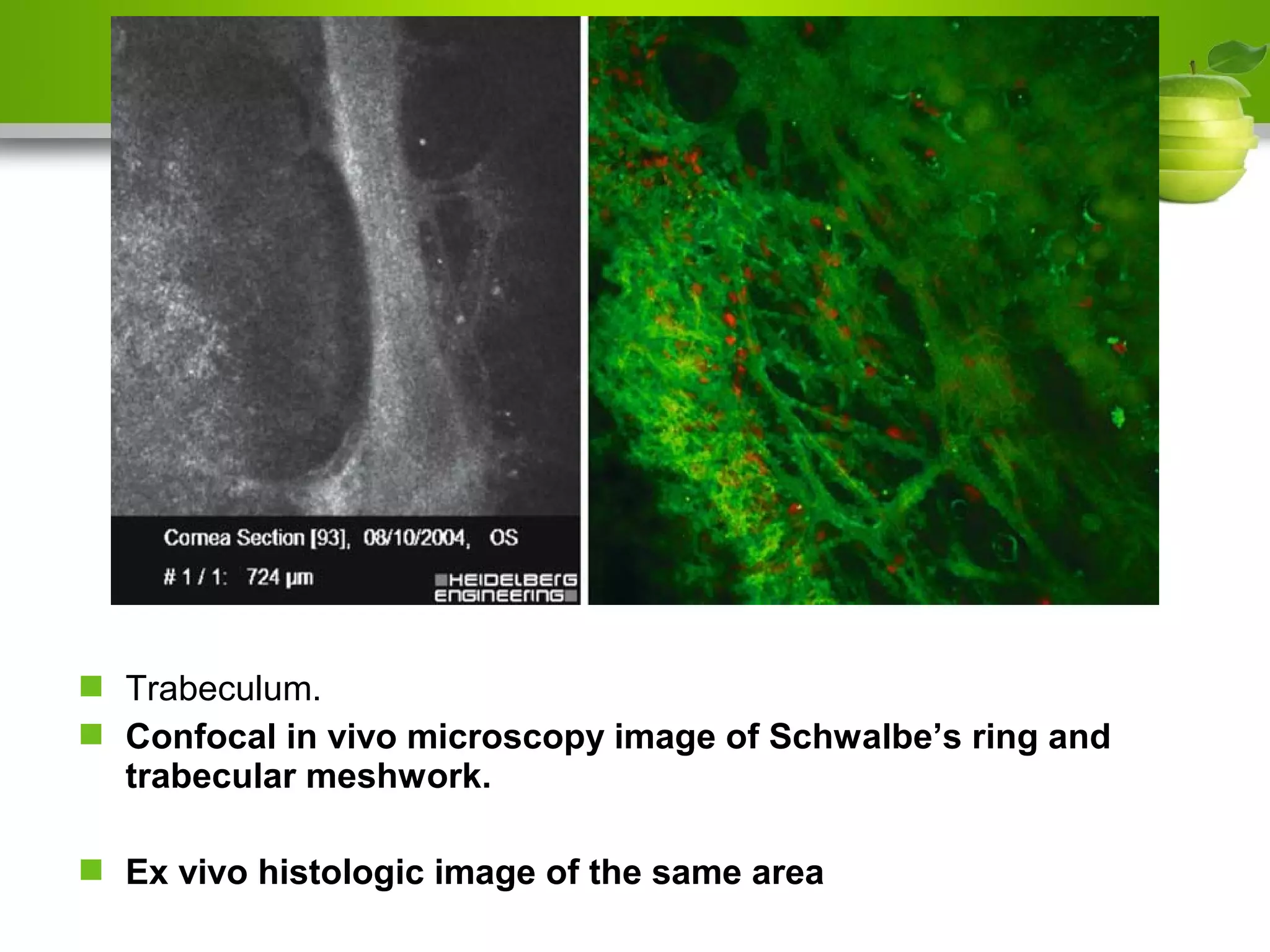 Confocal microscopy of the eye | PPT