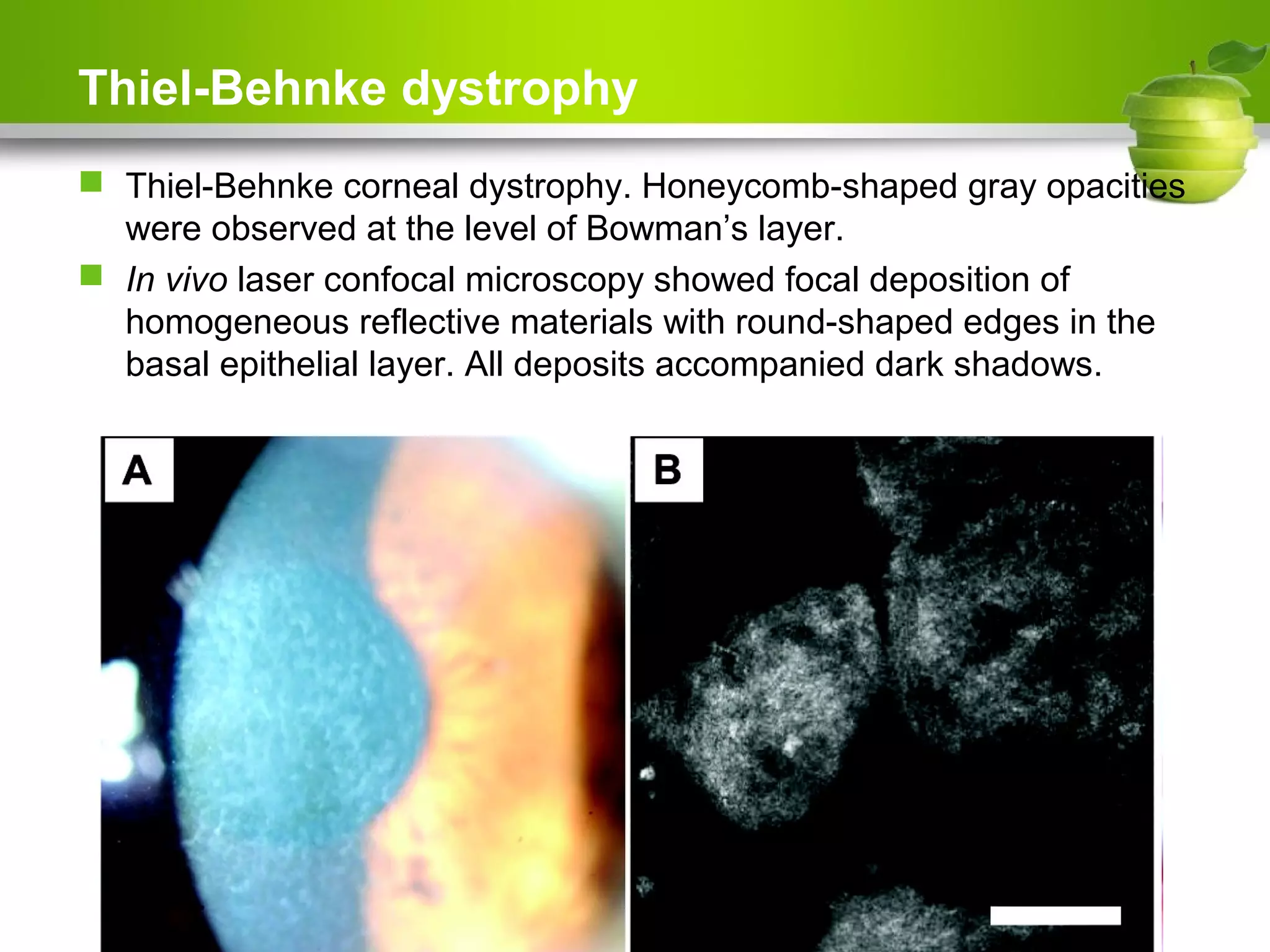 Confocal microscopy of the eye | PPT