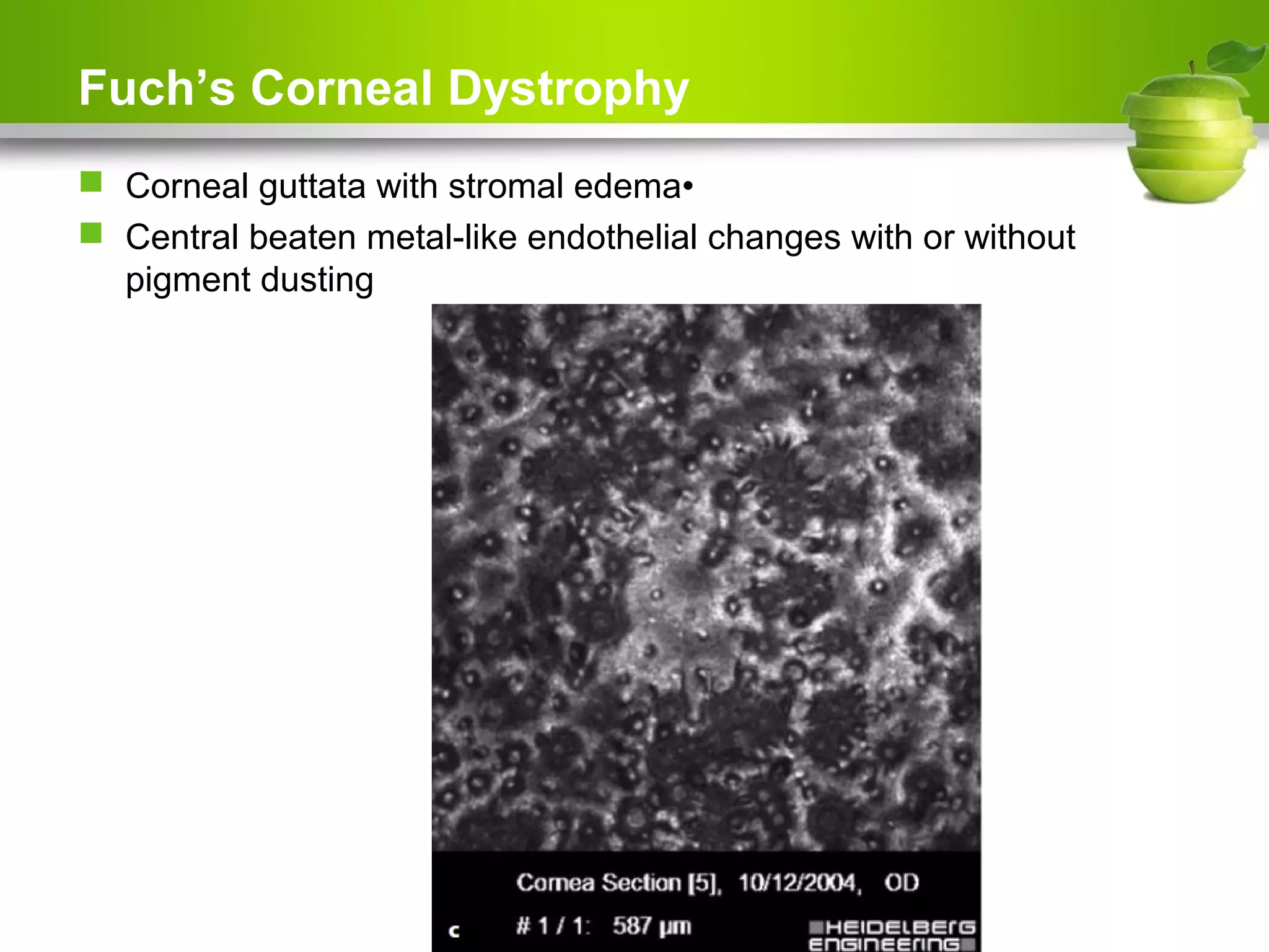 Confocal microscopy of the eye | PPT
