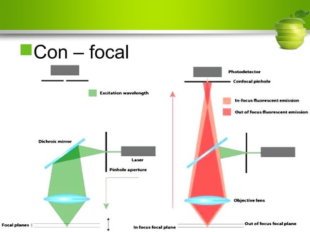 Confocal microscopy of the eye | PPT | Eye and Vision Conditions ...