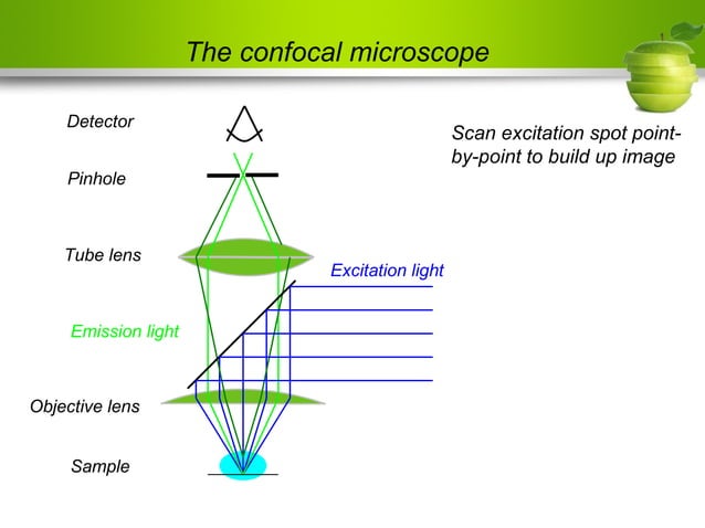 Confocal microscopy of the eye | PPT | Eye and Vision Conditions ...