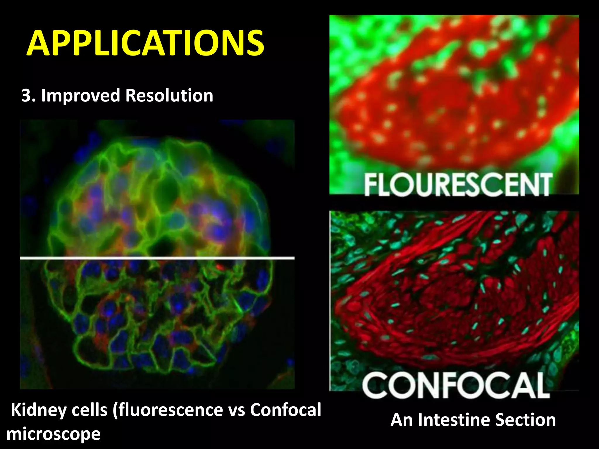 Confocal microscope presentation pt | PPTX
