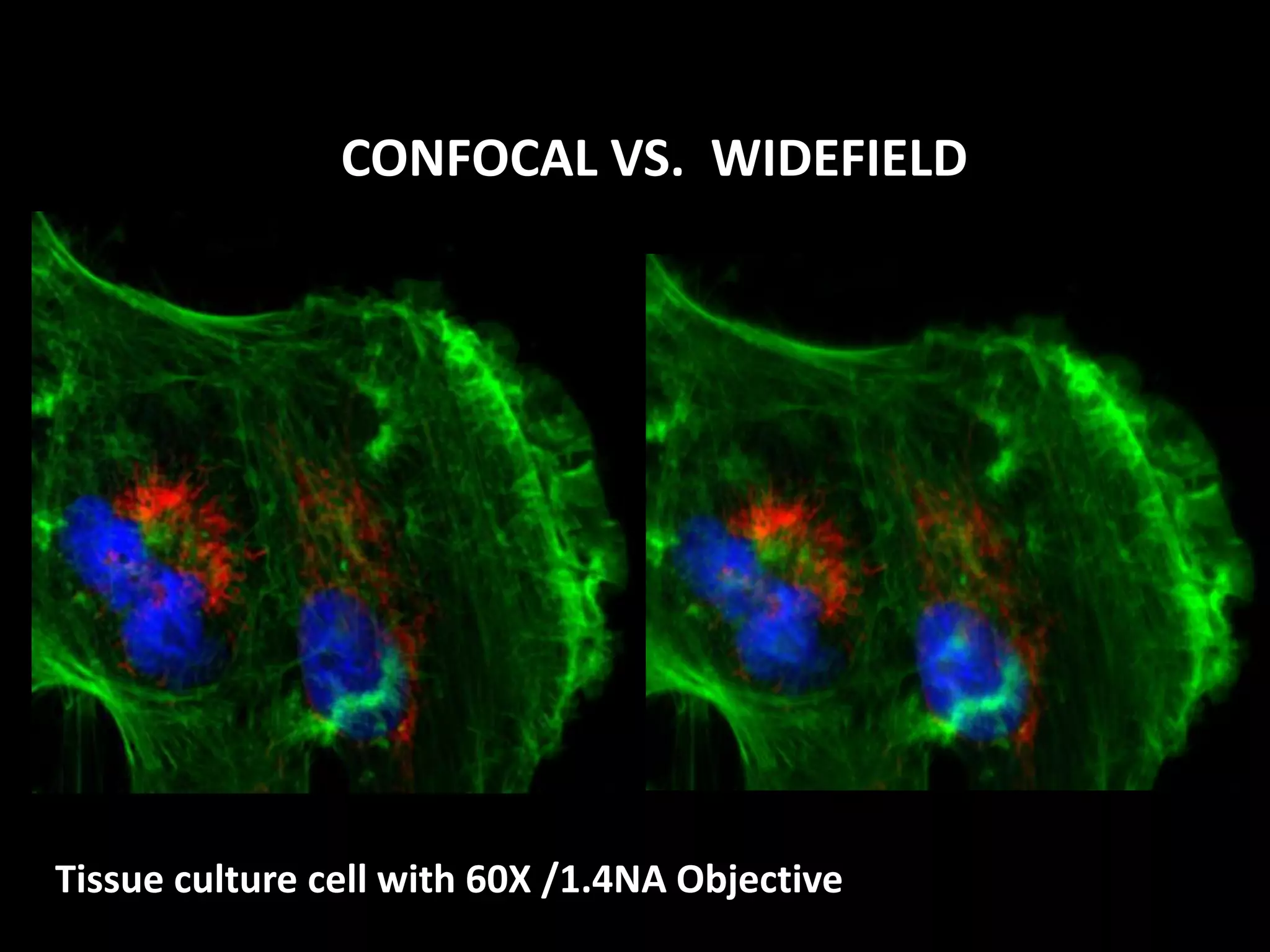 Confocal microscope presentation pt | PPTX