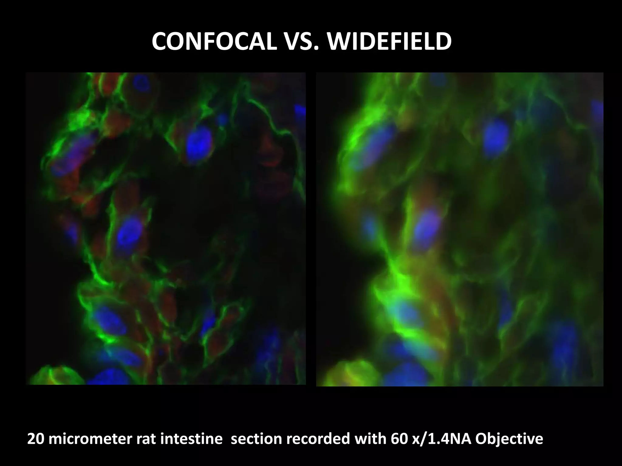 Confocal microscope presentation pt | PPTX