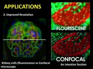 Confocal microscope presentation pt | PPTX