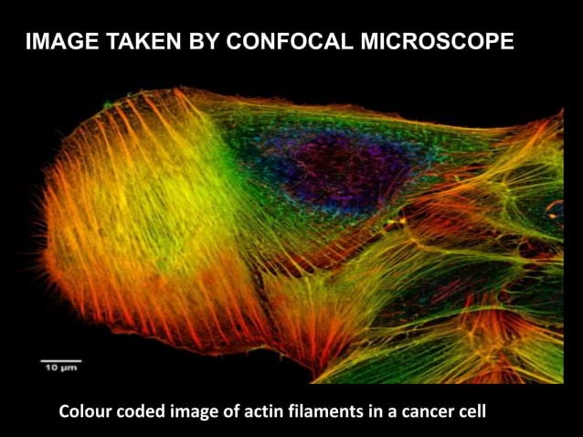 Confocal microscope presentation pt | PPTX