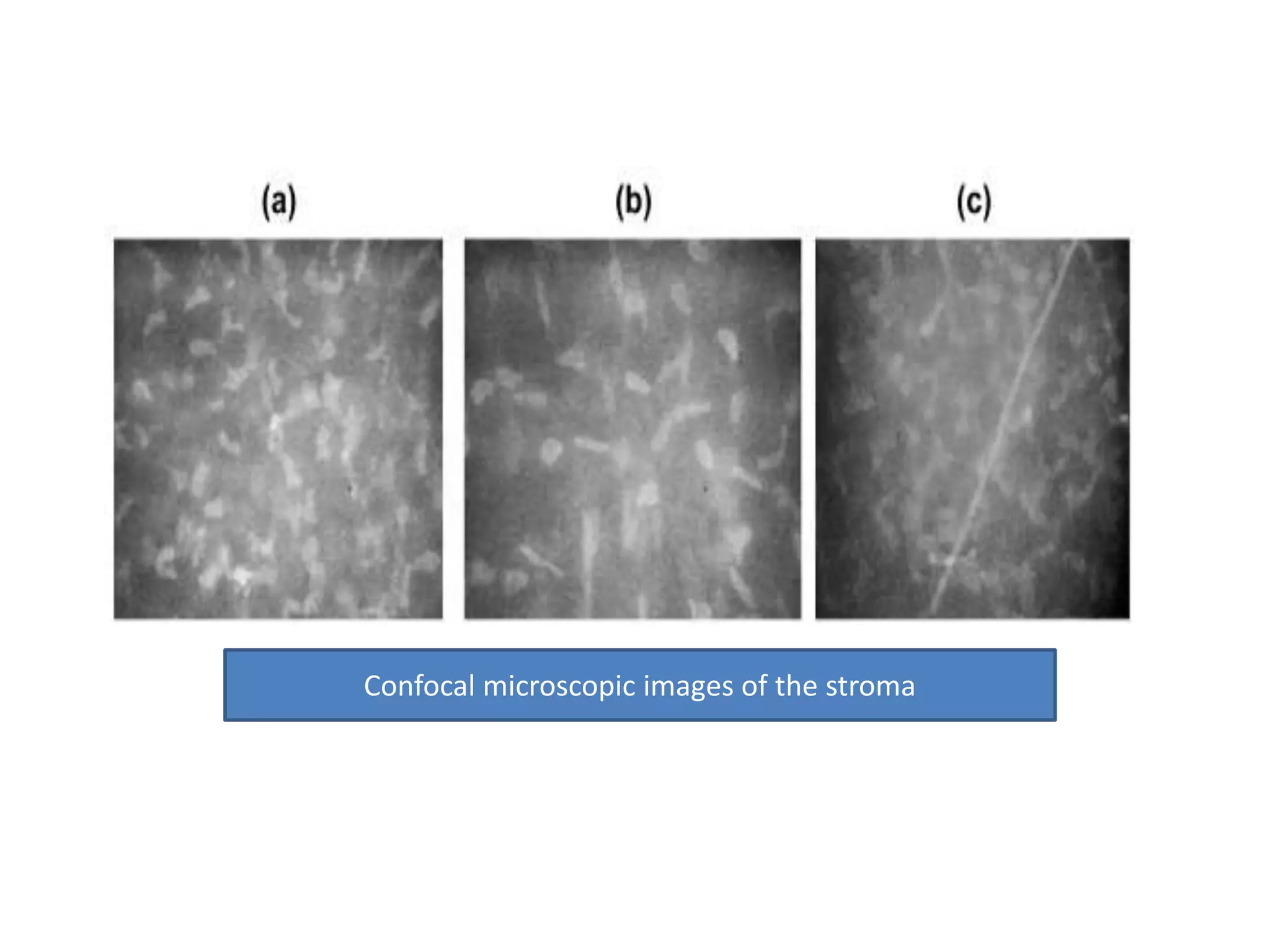 Confocal microscopy | PPTX