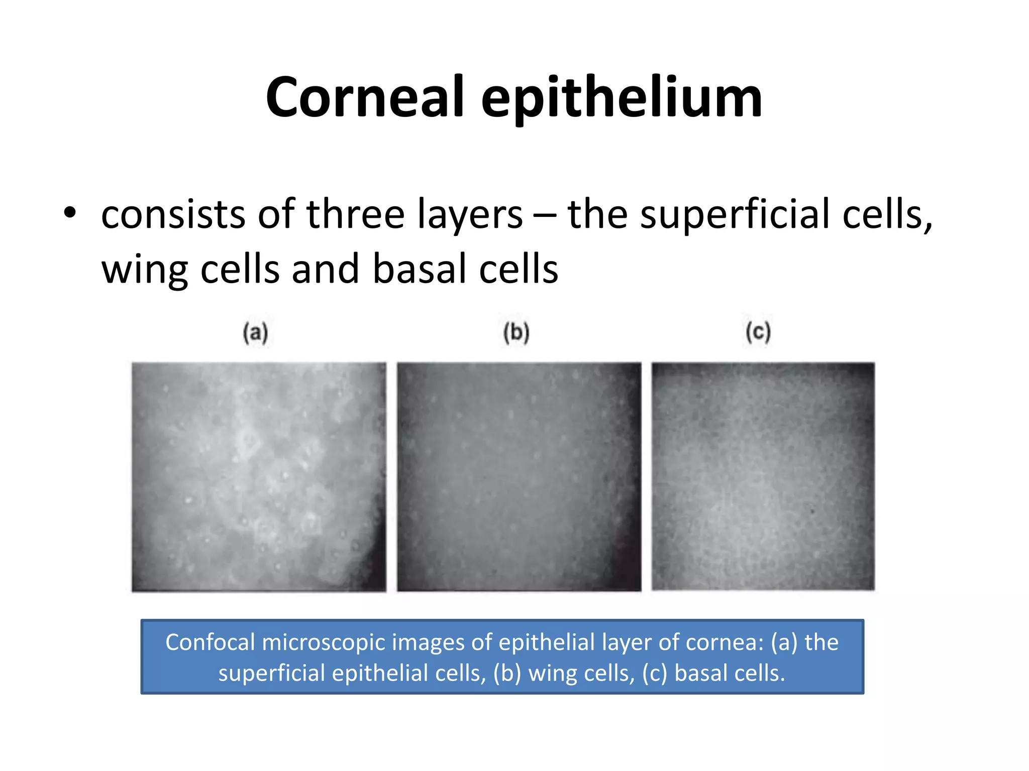 Confocal microscopy | PPTX