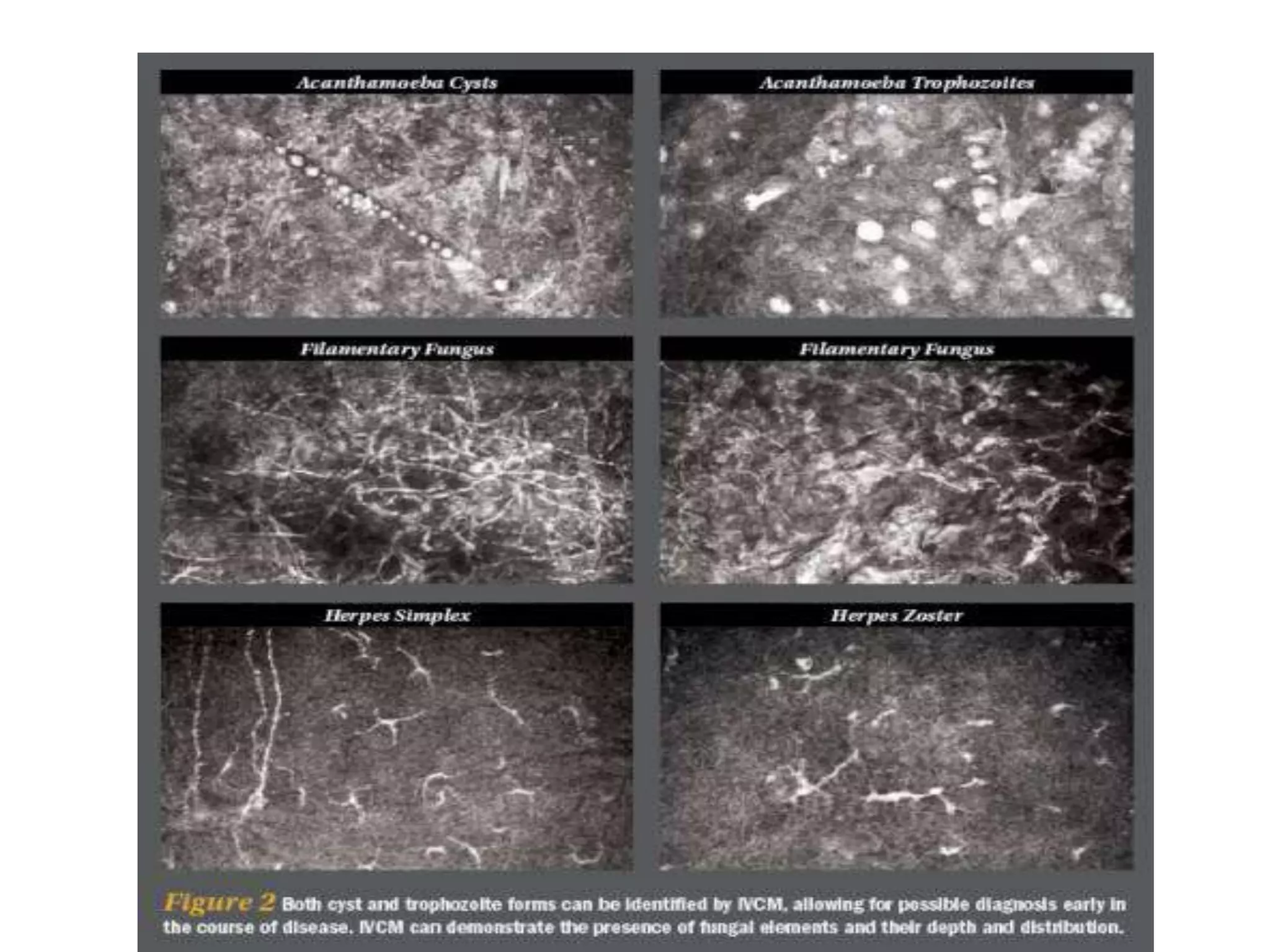 Confocal microscopy | PPTX | Eye and Vision Conditions | Diseases and ...
