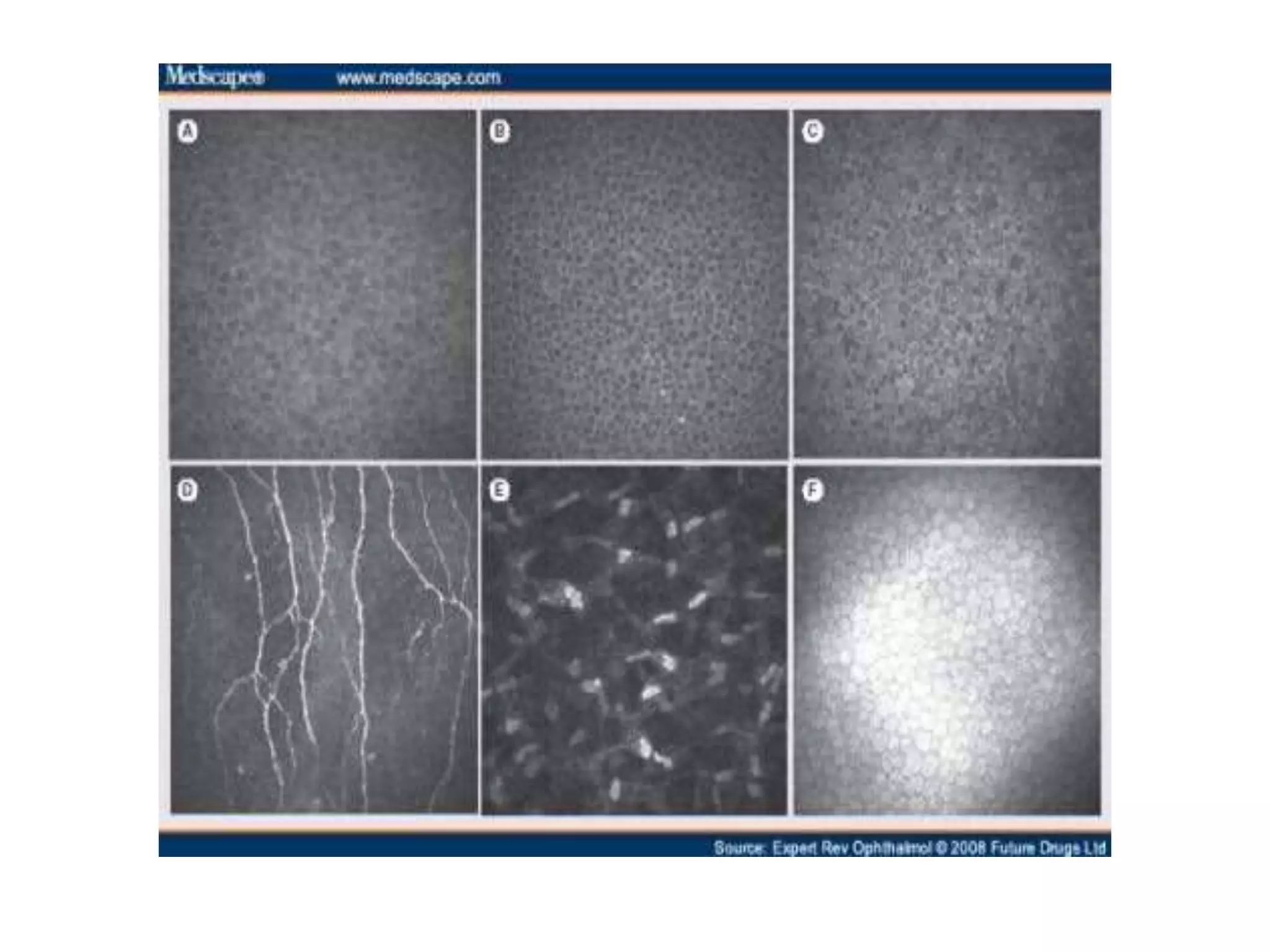 Confocal microscopy | PPTX | Eye and Vision Conditions | Diseases and ...