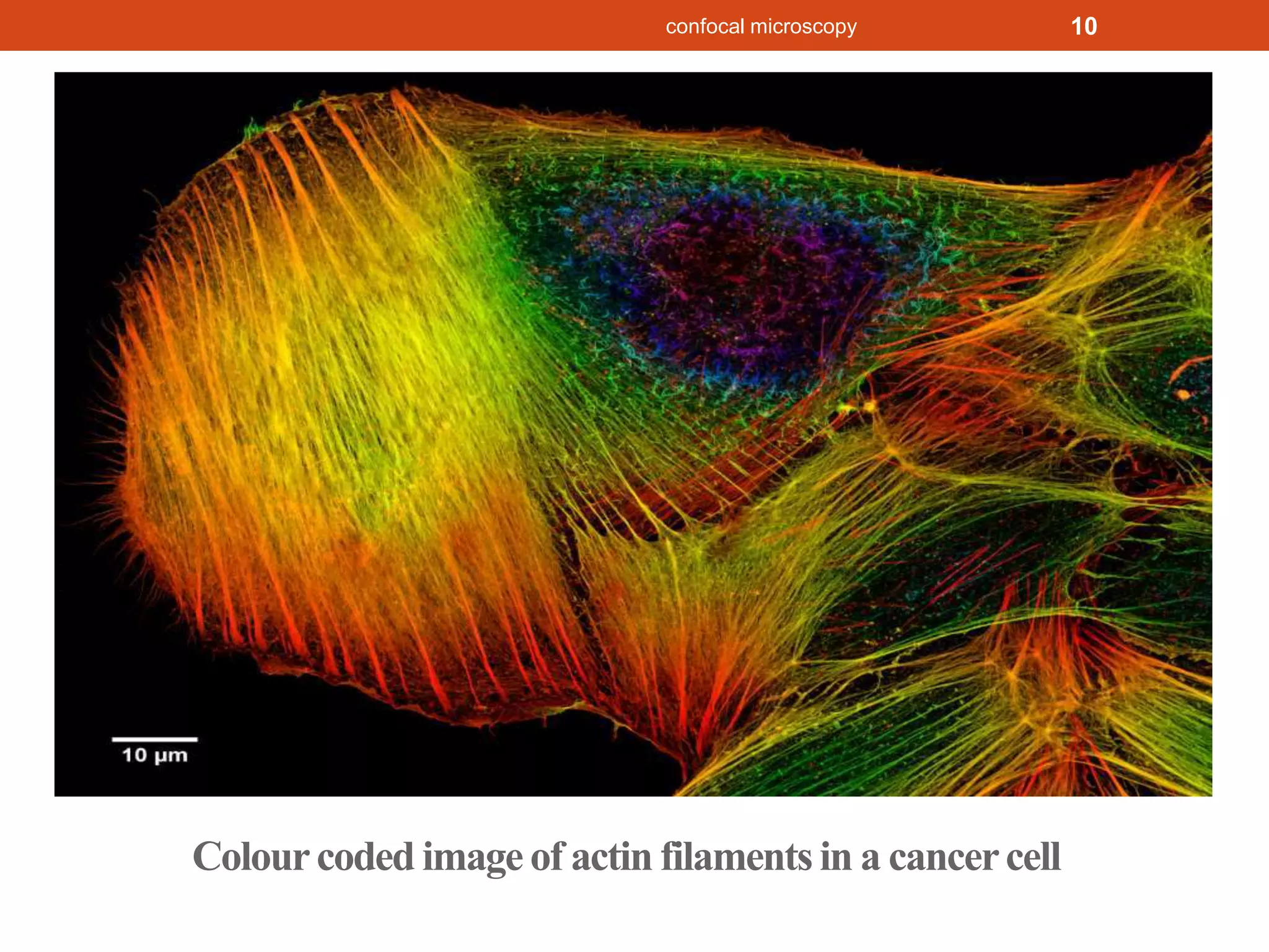 Confocal microscopy | PPT