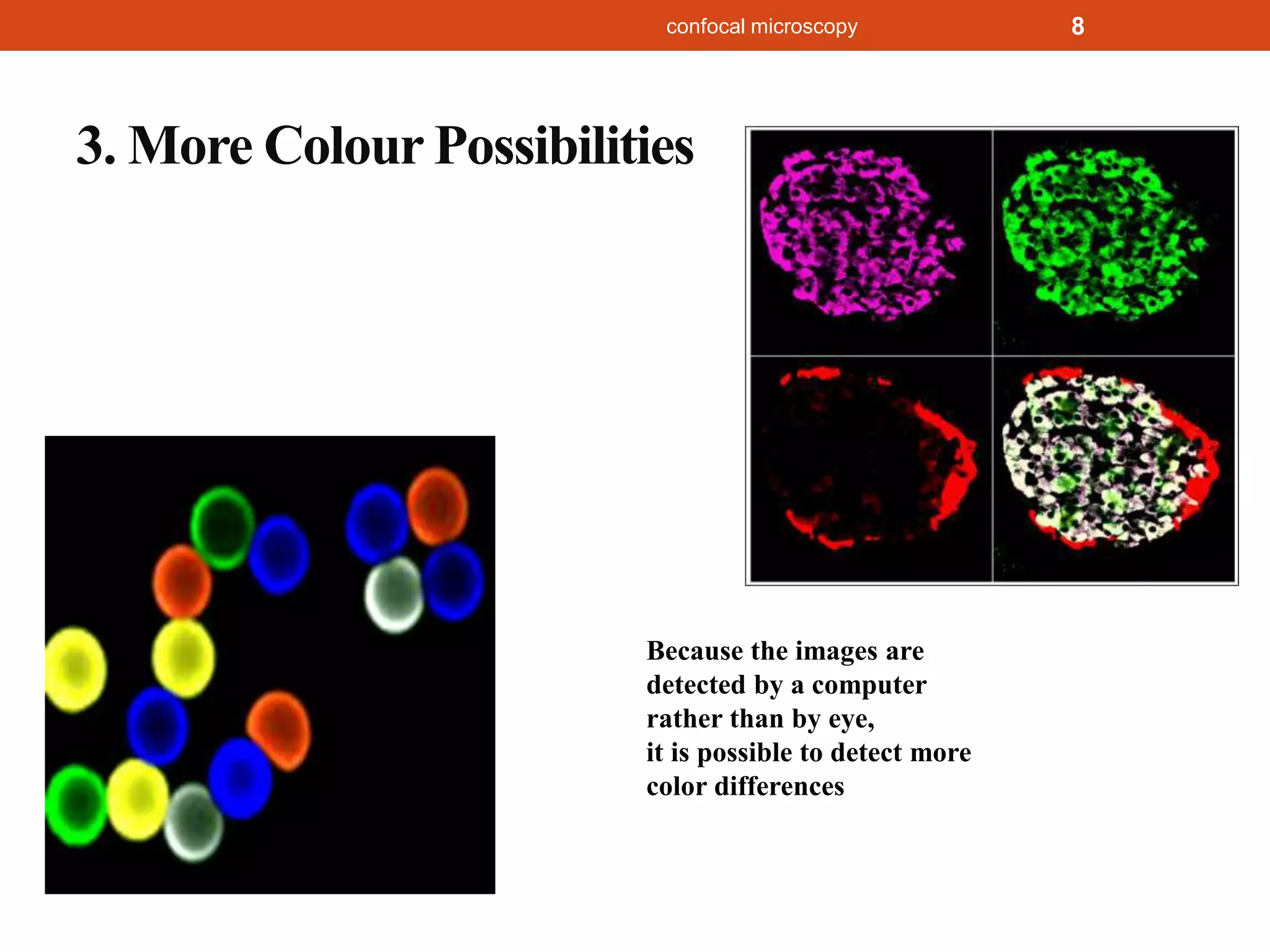Confocal microscopy | PPT