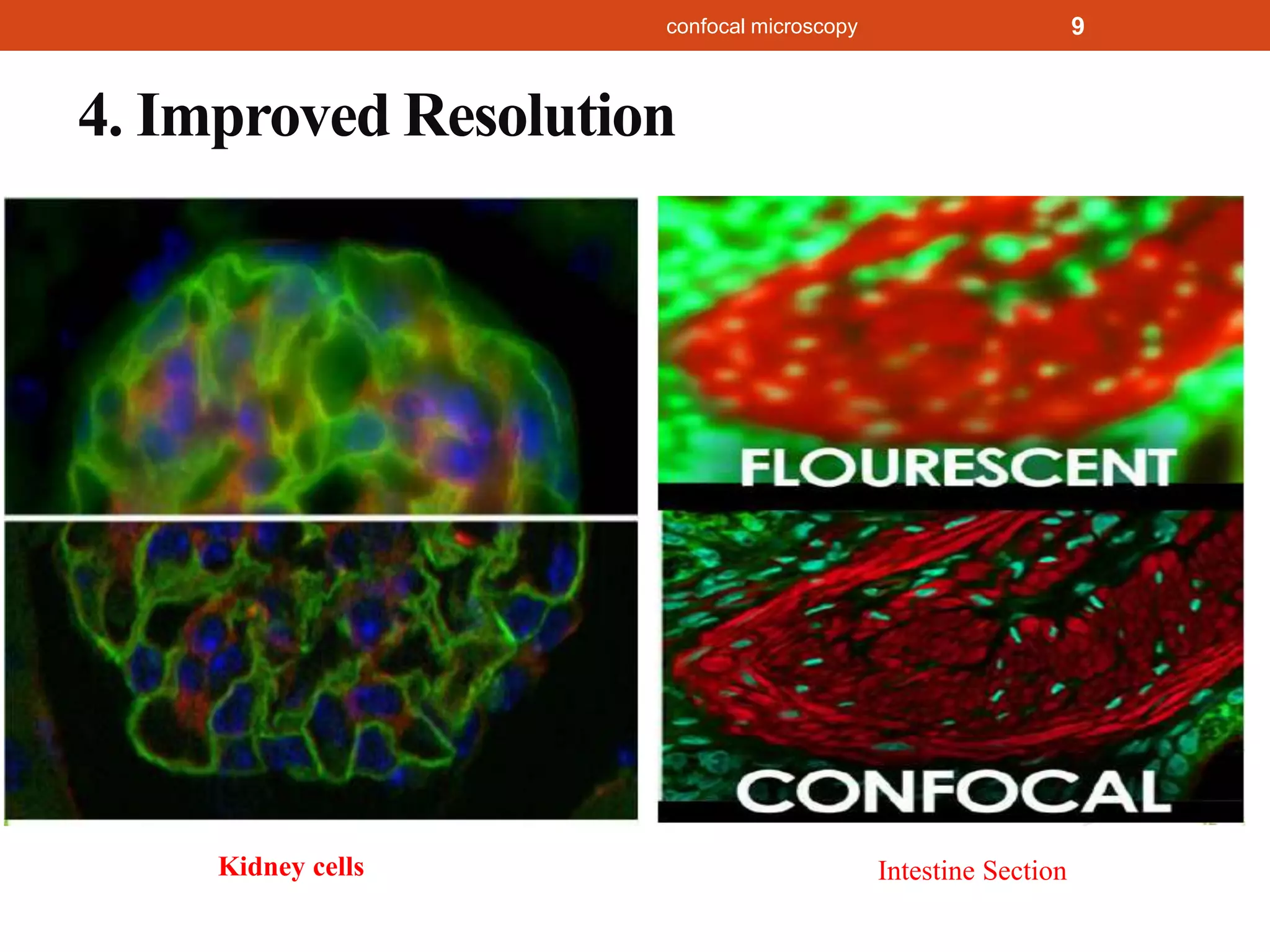 Confocal microscopy | PPT