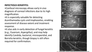 CONFOCAL MICROSCOPY in detail for postgraduates.pdf