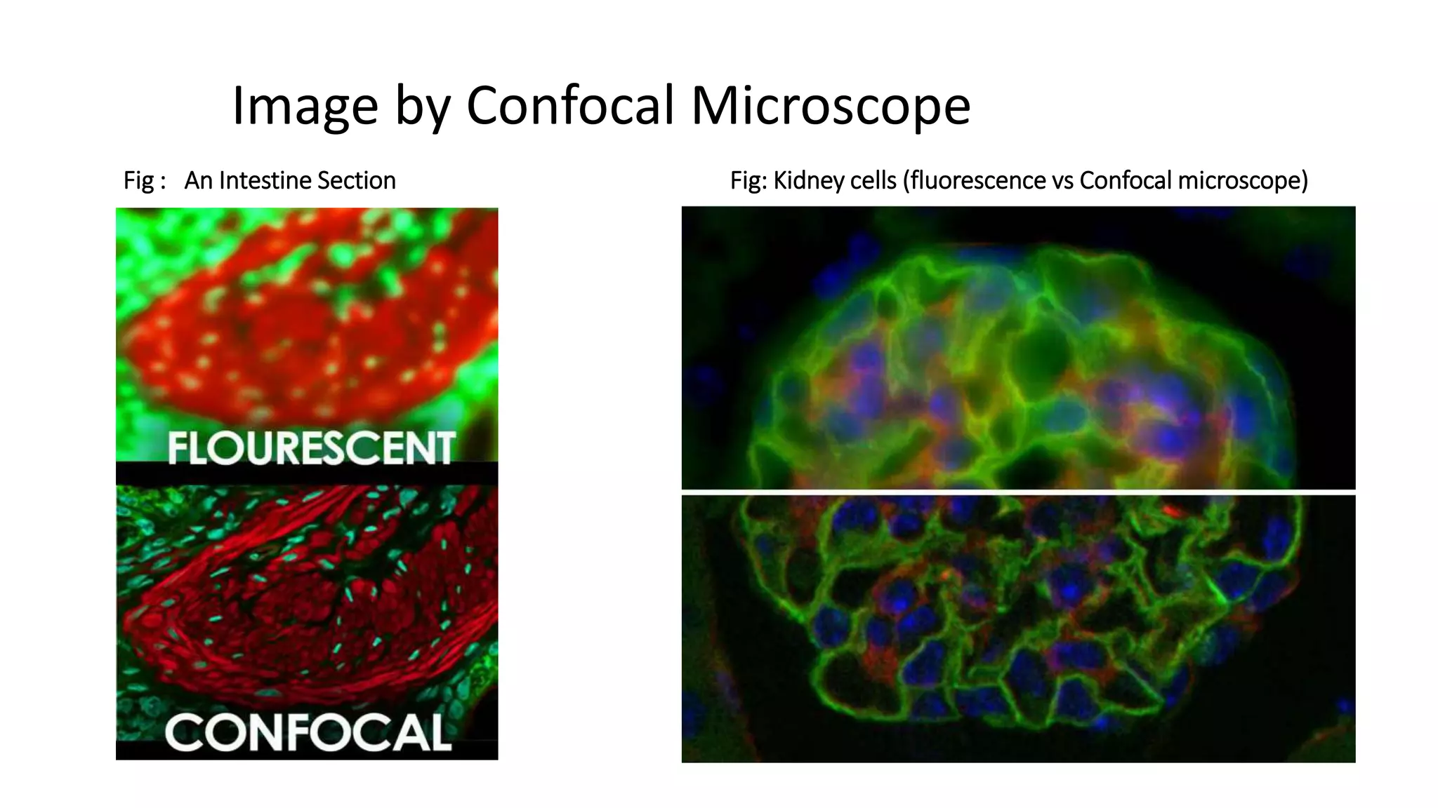 Confocal microscopy by prabhat | PPTX