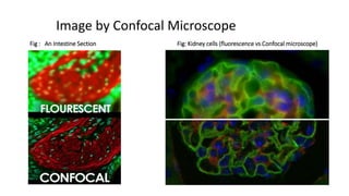 Confocal microscopy by prabhat | PPTX