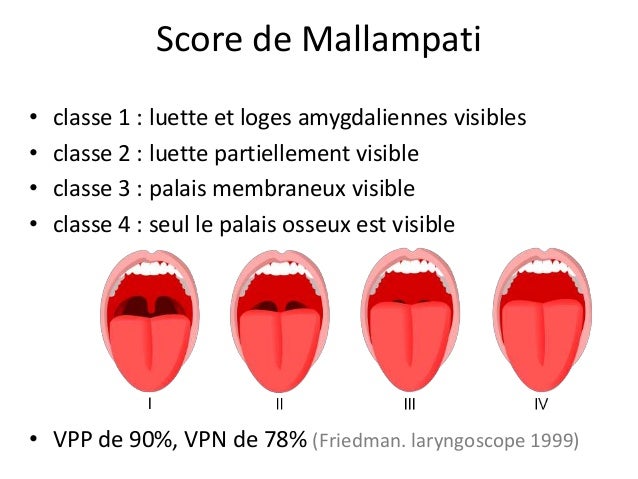 Conférence moyens diagnostic du saos