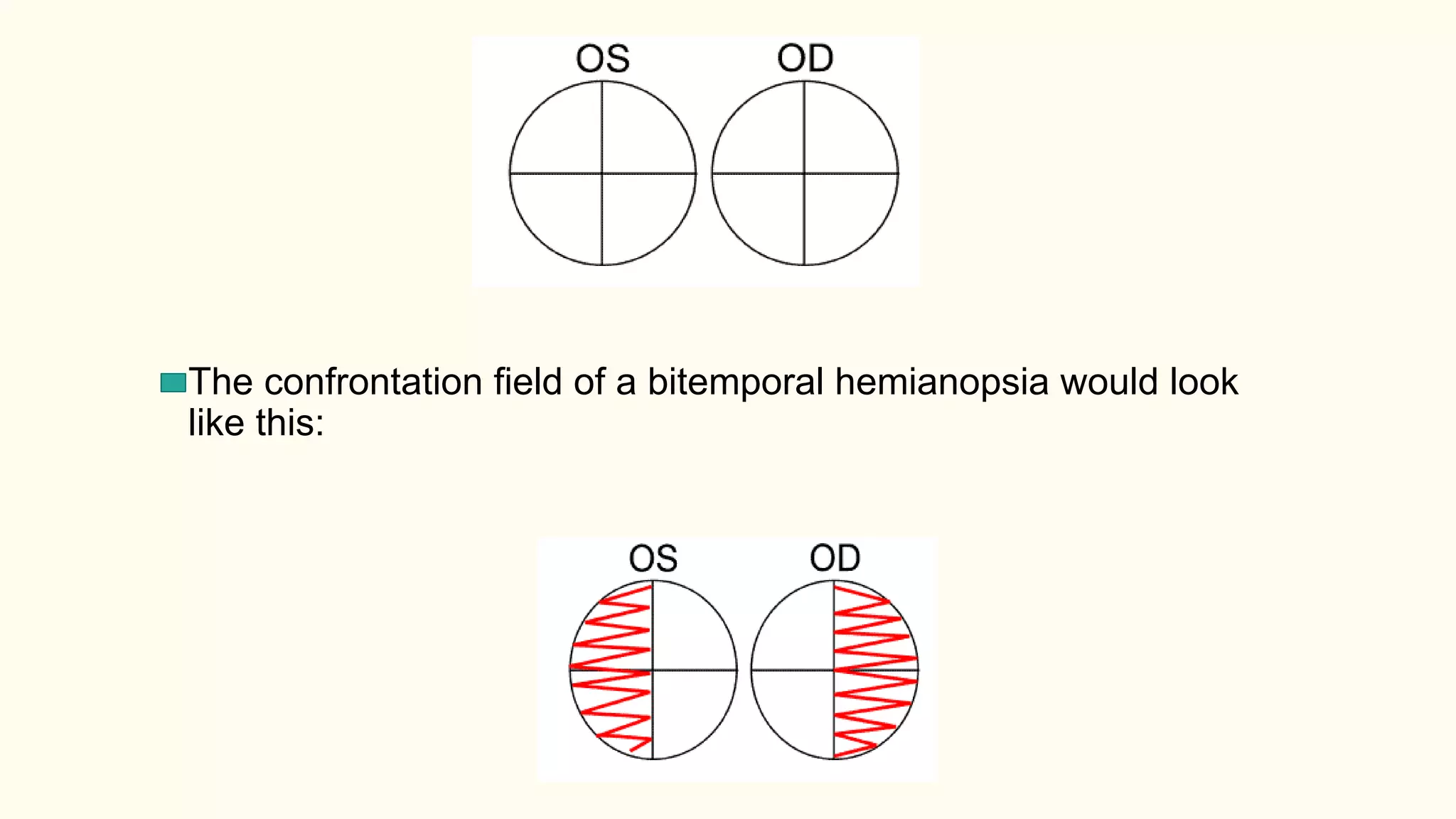 Confrontation. | PPTX