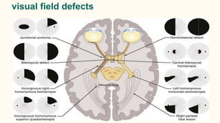 Confrontation. | PPTX