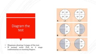Confrontation test | PPTX