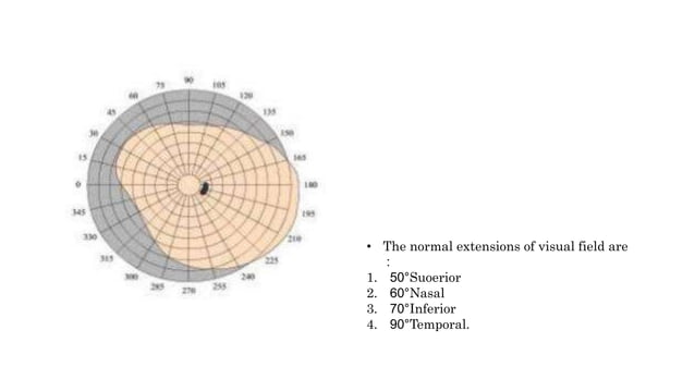 Confrontation test | PPTX | Eye and Vision Conditions | Diseases and ...