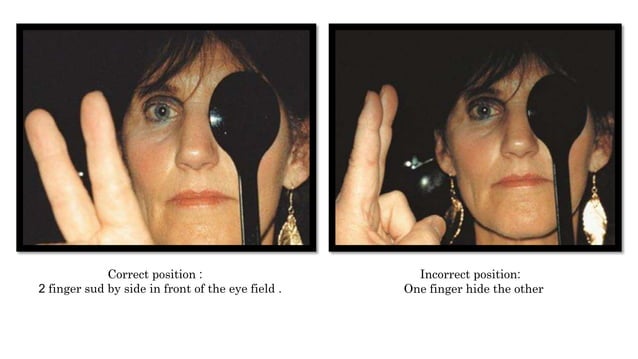 Confrontation test | PPTX | Eye and Vision Conditions | Diseases and ...