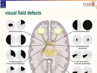 confrontation test Ramji Pandey consultant optometrist | PPTX