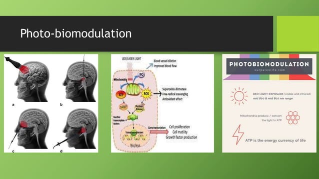 post operative cognitive dysfunction | PPTX