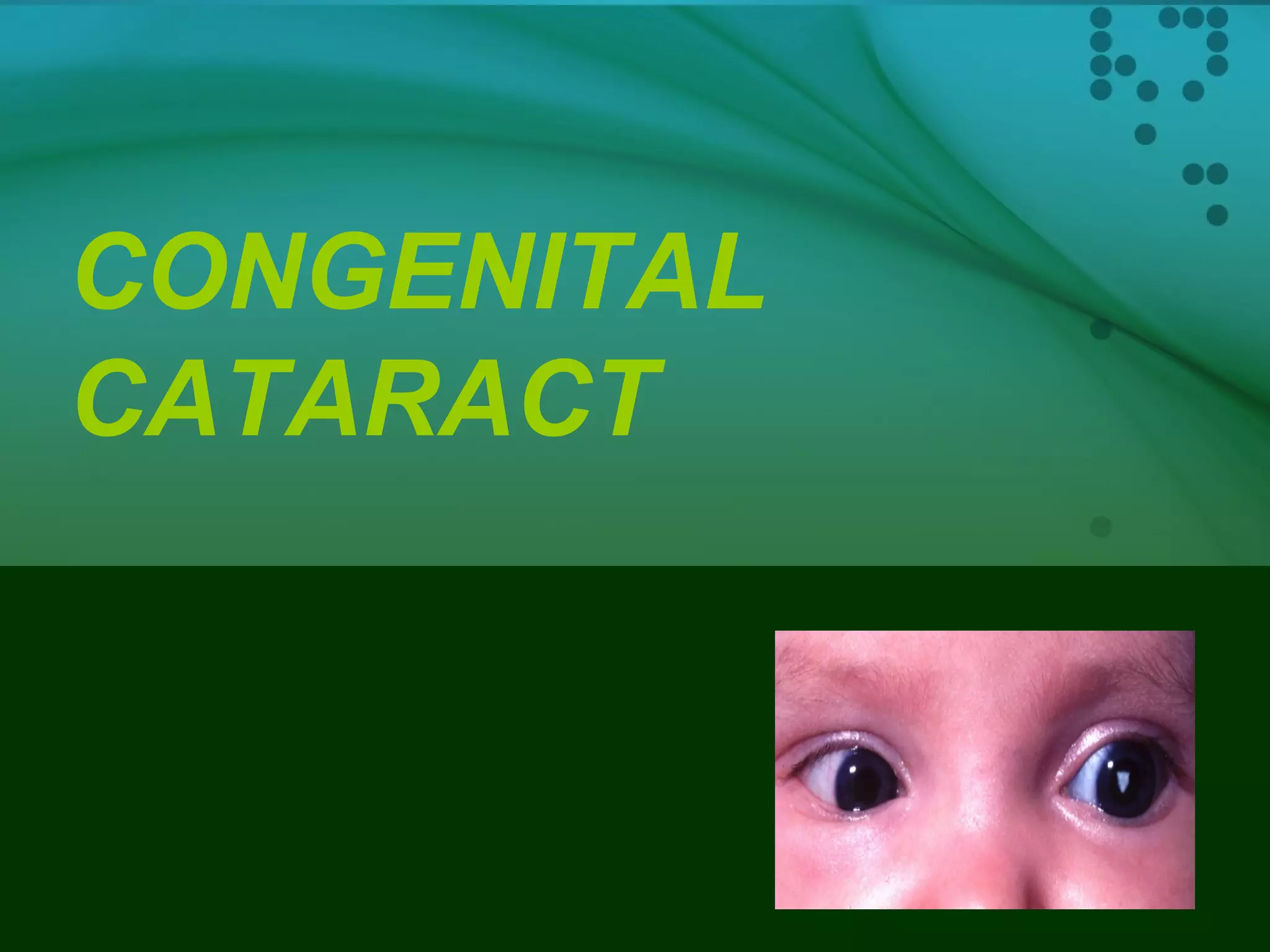 congenital glaucoma and congenital cataract | PPT