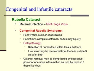Congenital & infantile cataract | PPT