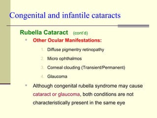 Congenital & infantile cataract | PPT