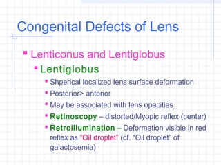 Congenital defects of the lens | PPT