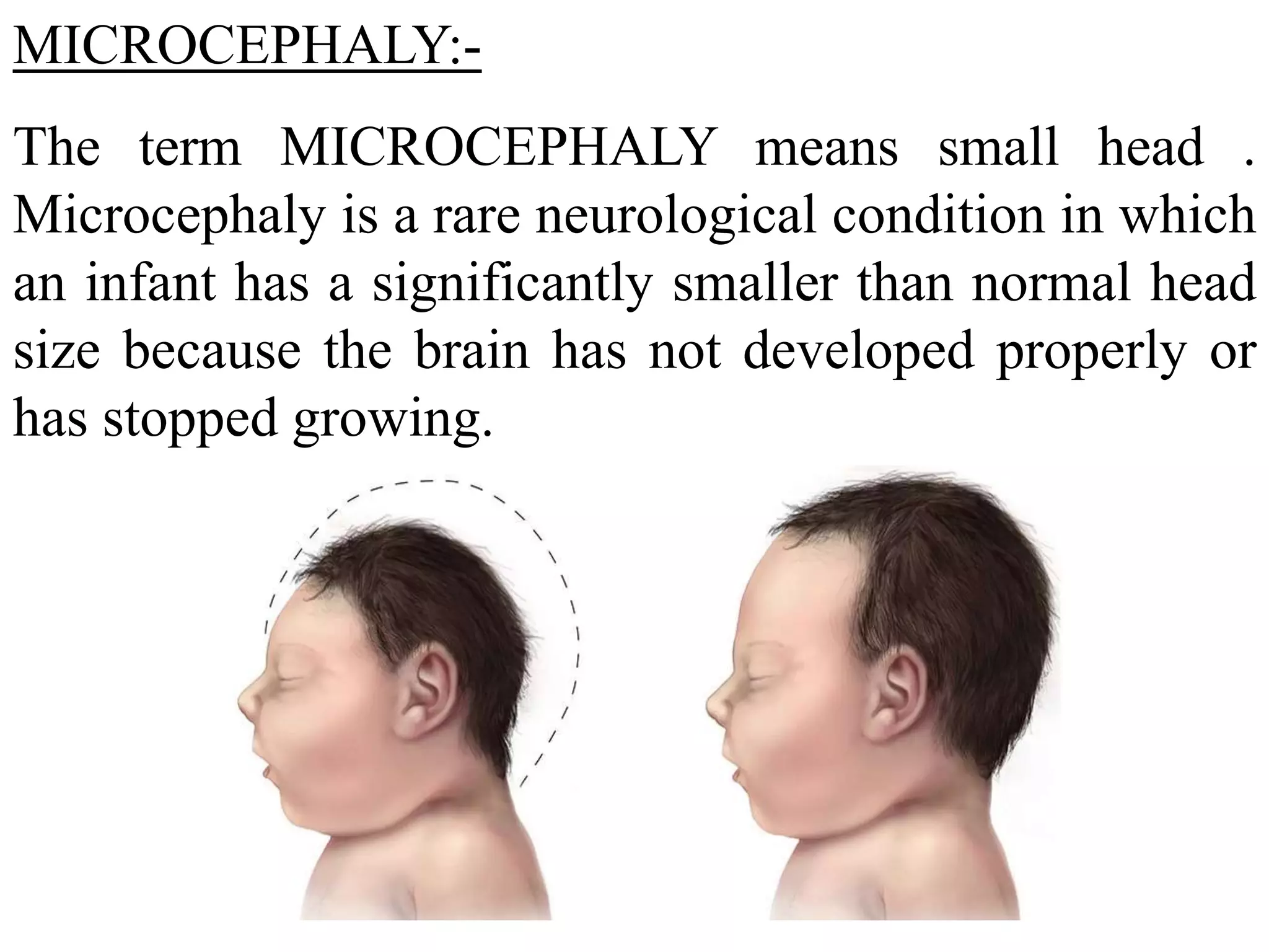 CONGENITAL.pptx