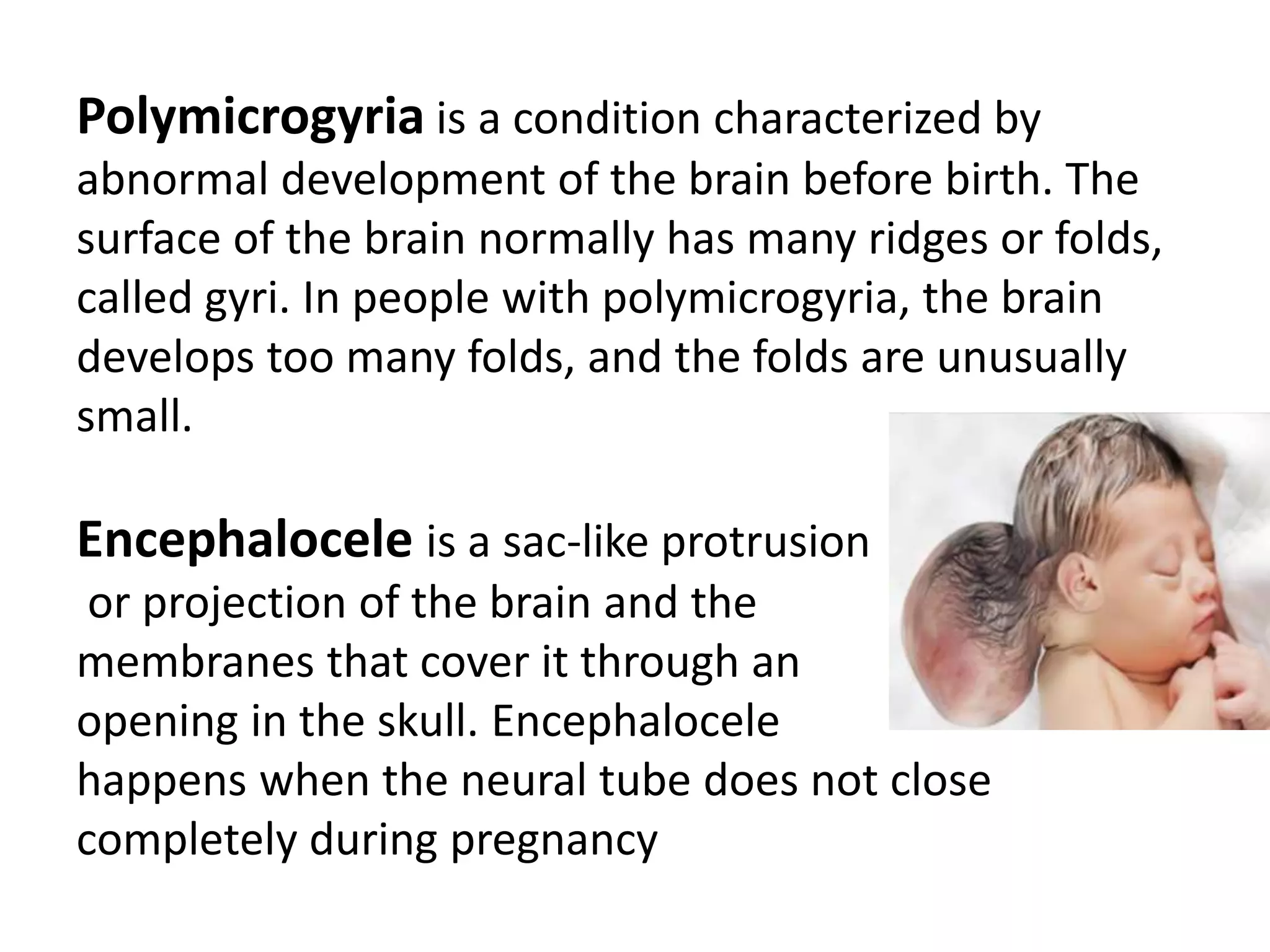 CONGENITAL.pptx