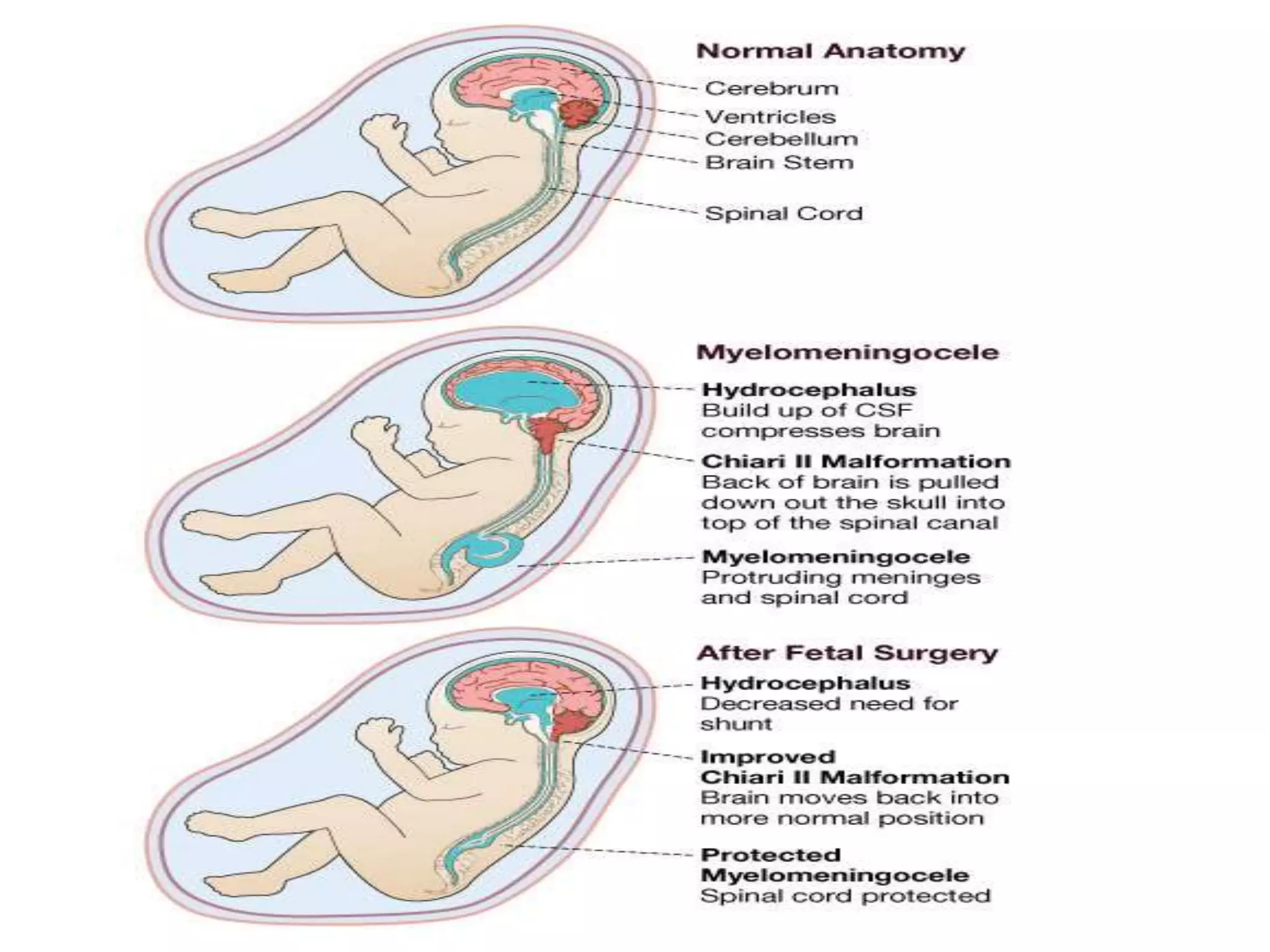CONGENITAL.pptx