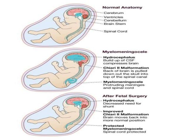 CONGENITAL.pptx