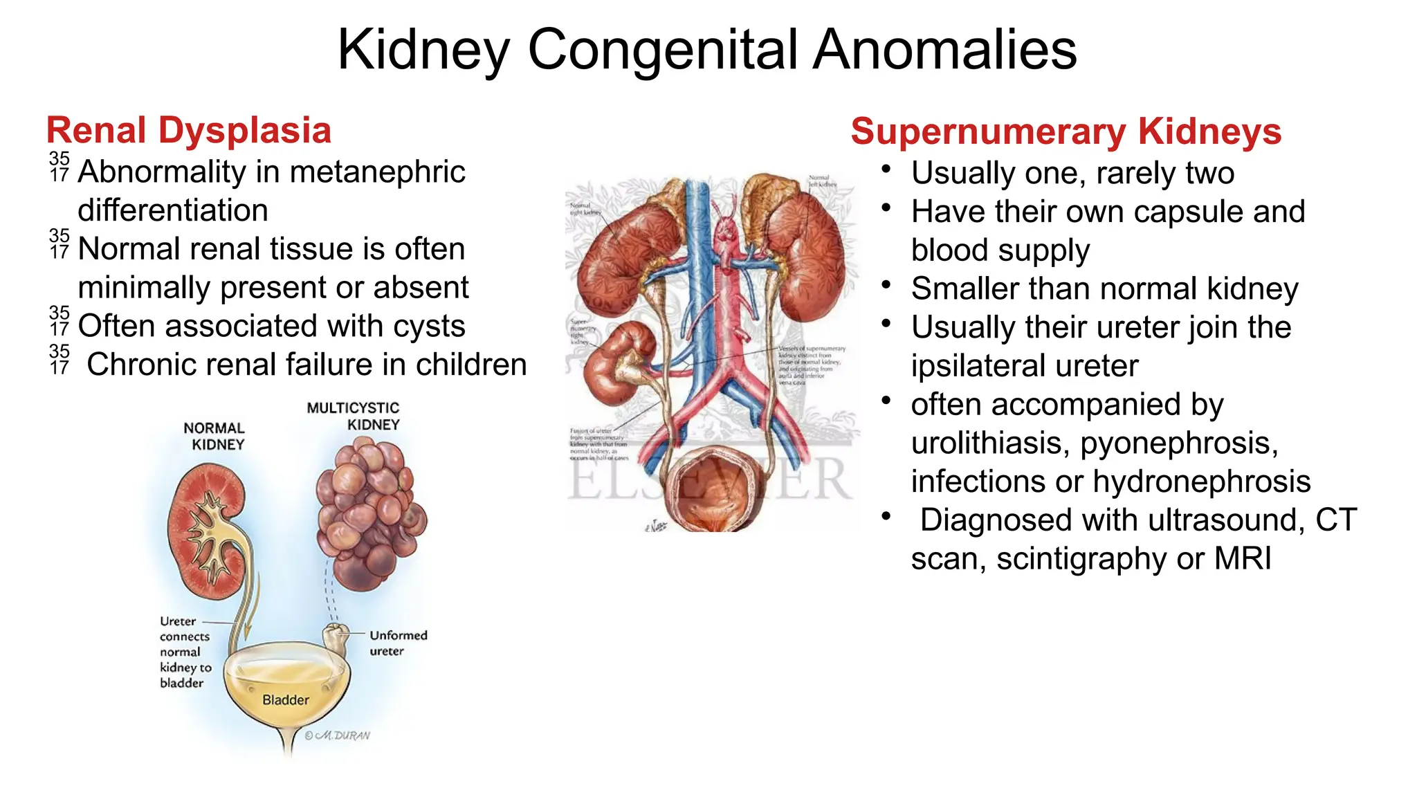 Congenital Anomalies Urinary System Pptx