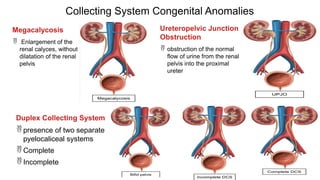 congenital-anomalies-urinary-system.pptx