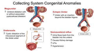 Congenital Anomalies Urinary System Pptx