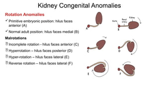 congenital-anomalies-urinary-system.pptx