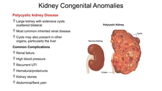 congenital-anomalies-urinary-system.pptx