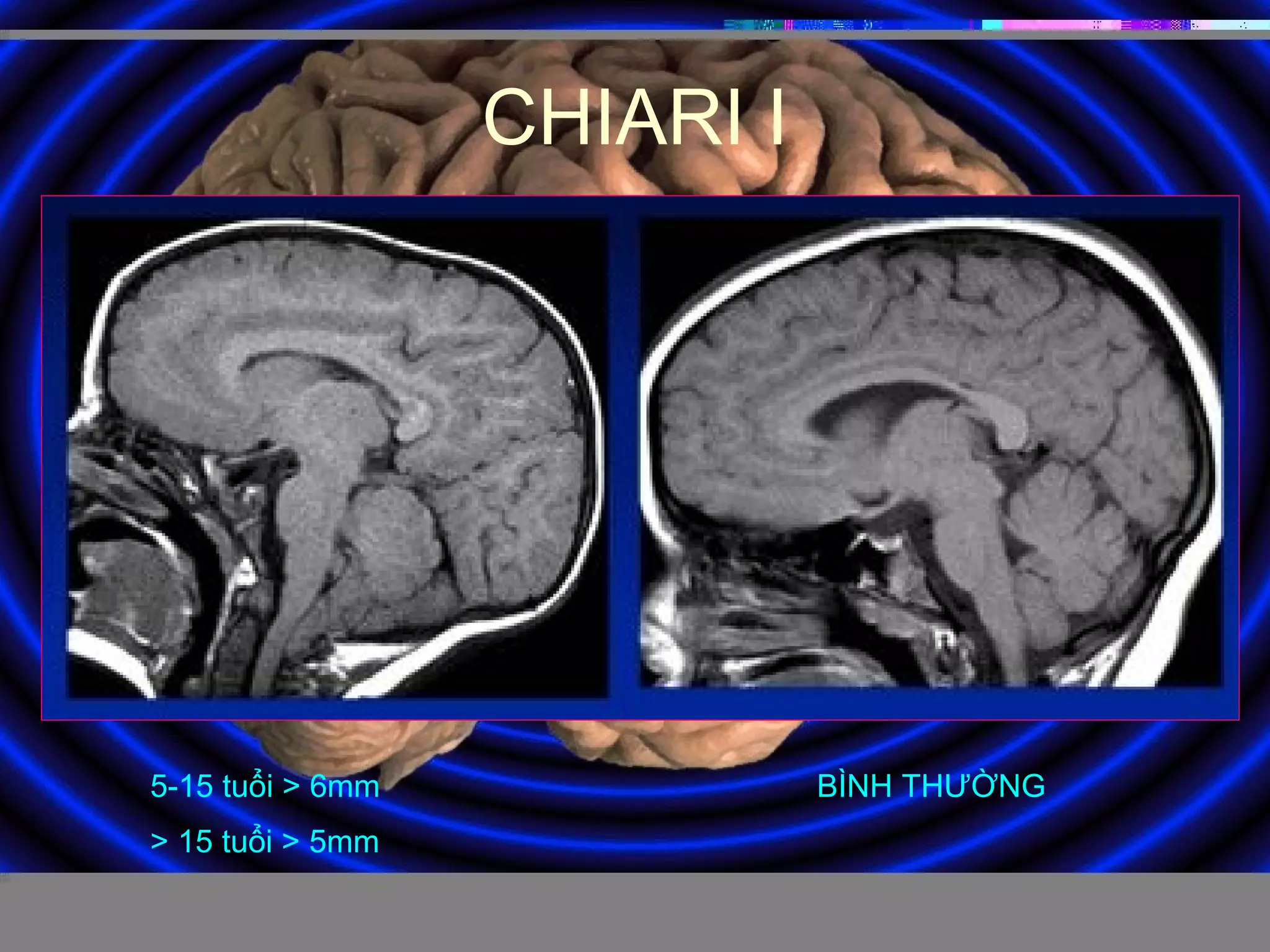 Congenital Brain Malformation | PPT