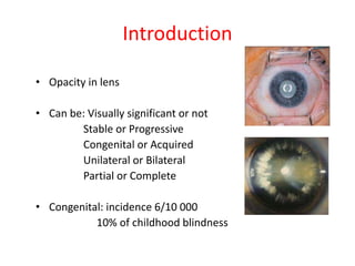 Congenital cataract | PPT