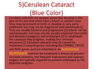 Cerulean Cataract